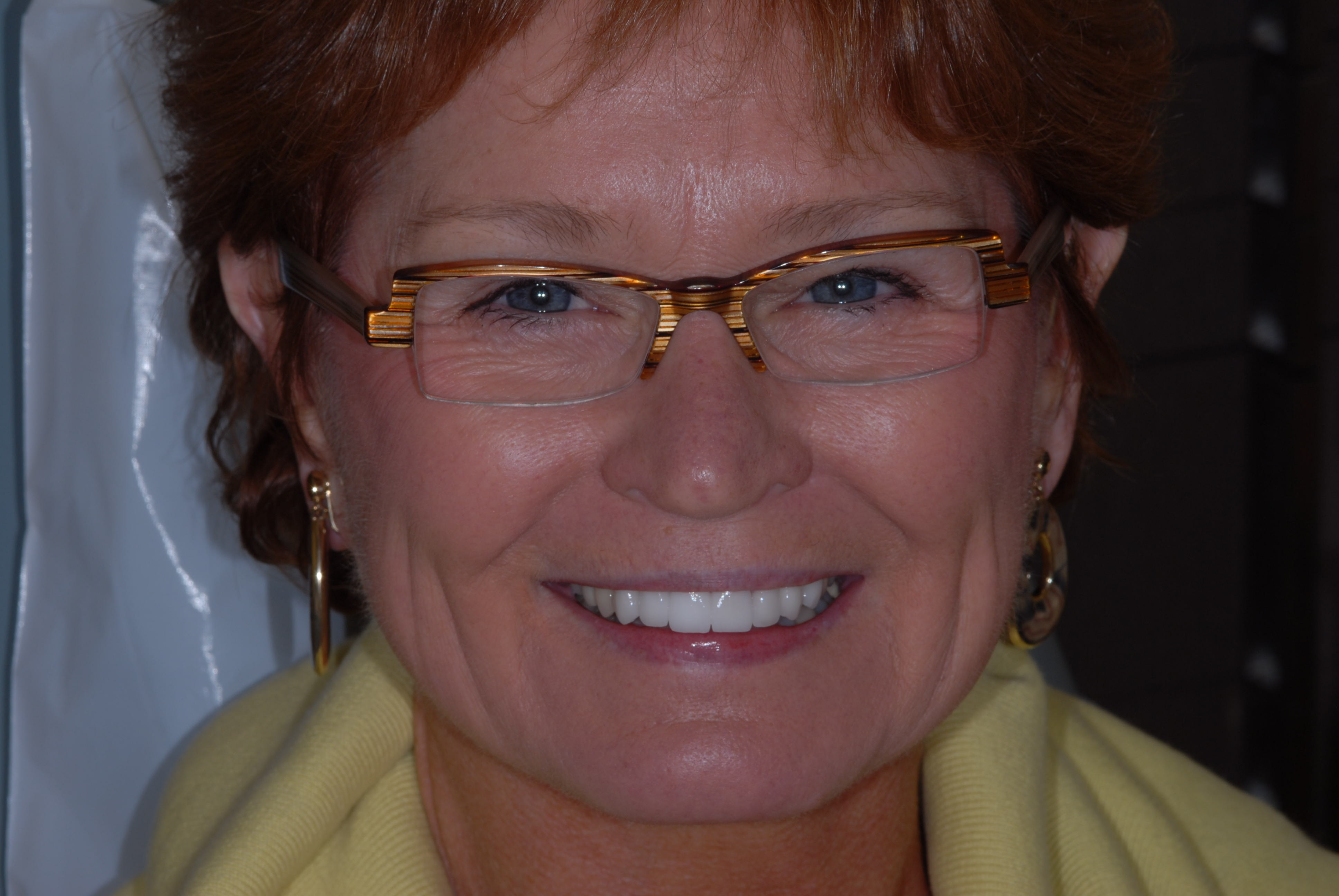 Dr. Hagood’s Smile Gallery | Verobeachartofdentistry.com